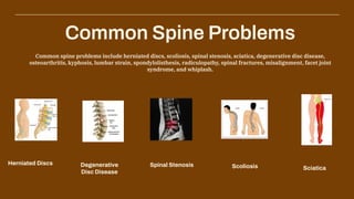 Common Spine Problems Know When To See An Orthopedic Doctor.pdf