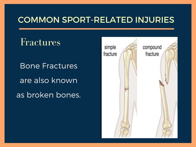 Common sport injuries and first aid procedures.pptx