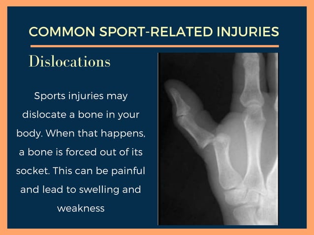 Common sport injuries and first aid procedures.pptx