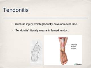 Common sports injuries.2560