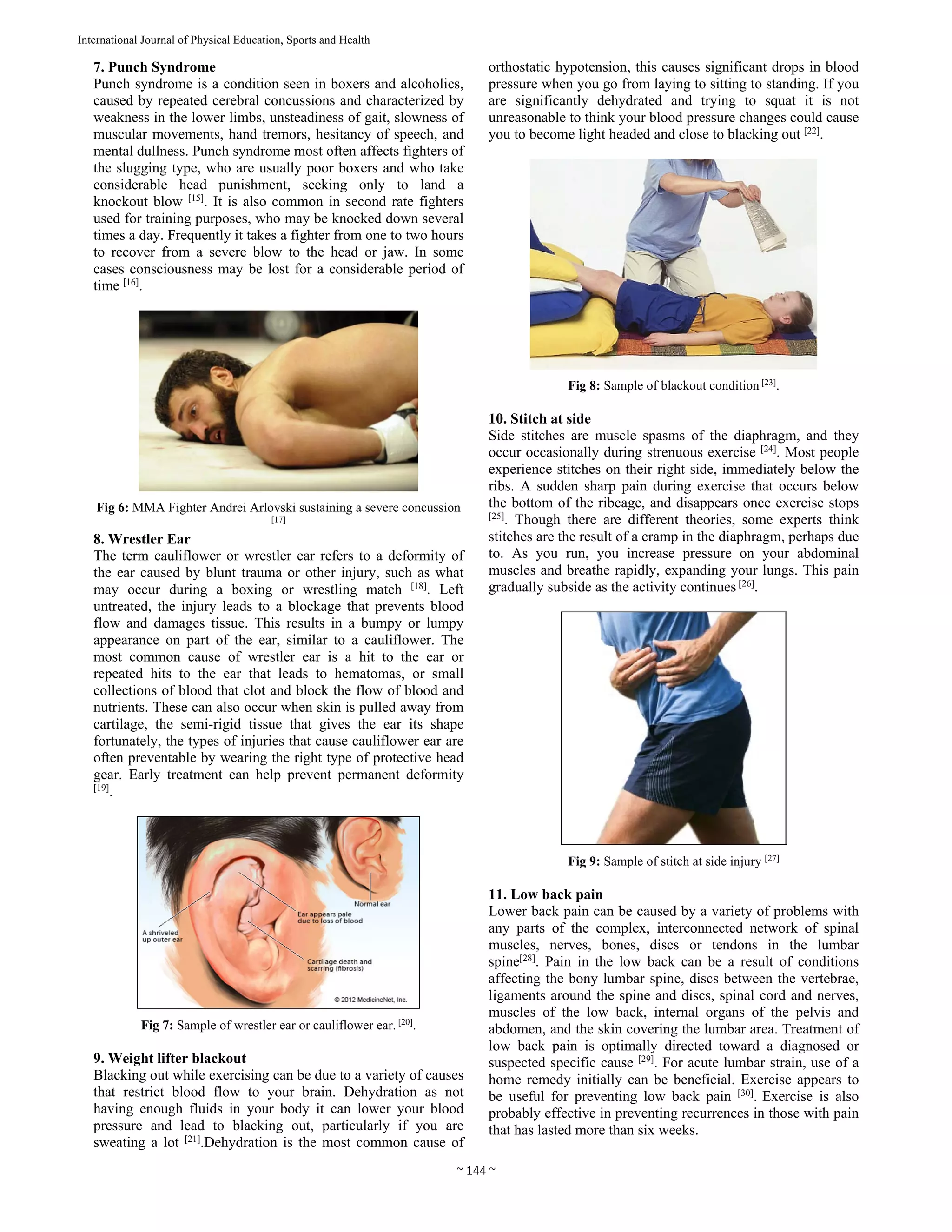 Common sports injuries | PDF