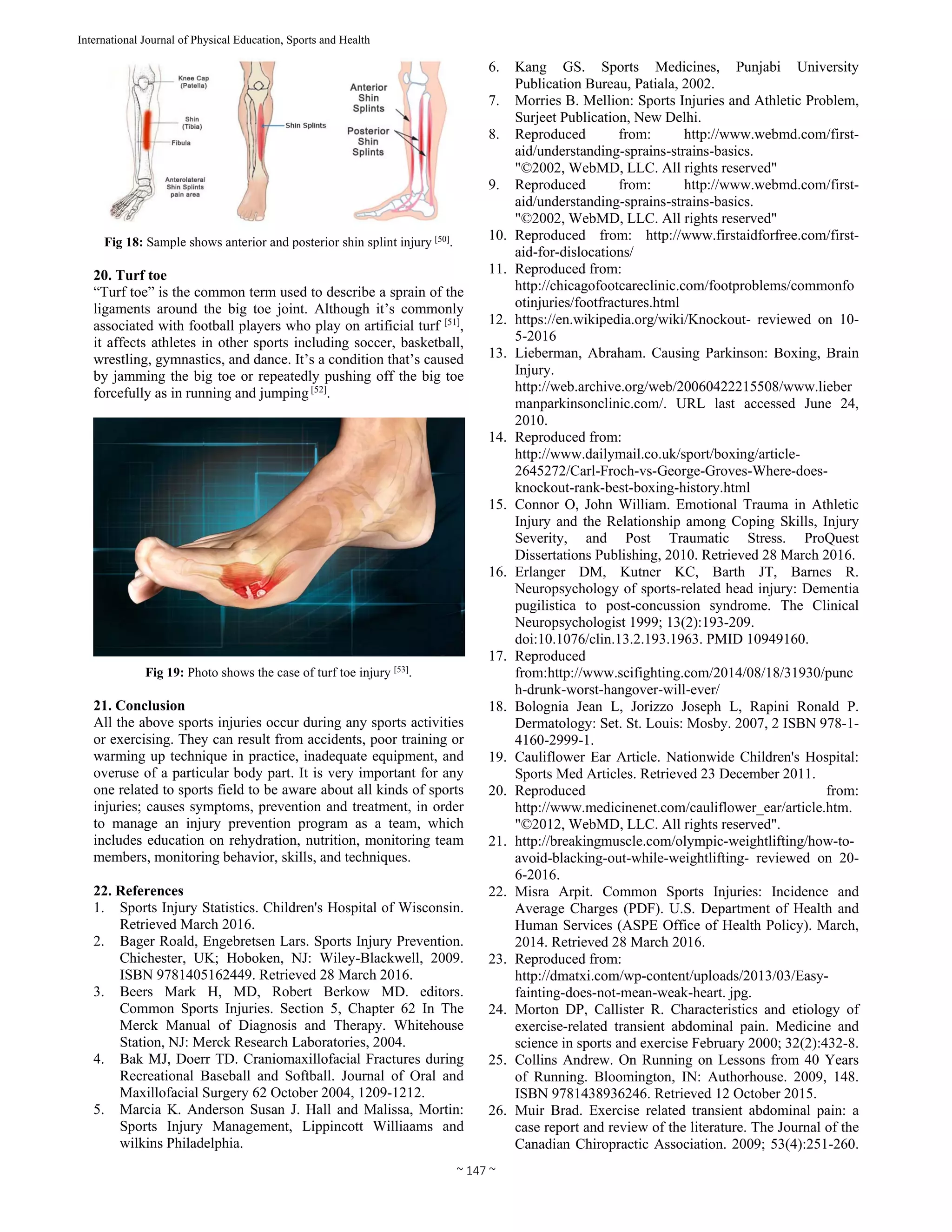 Common sports injuries | PDF