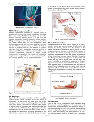 Common sports injuries | PDF
