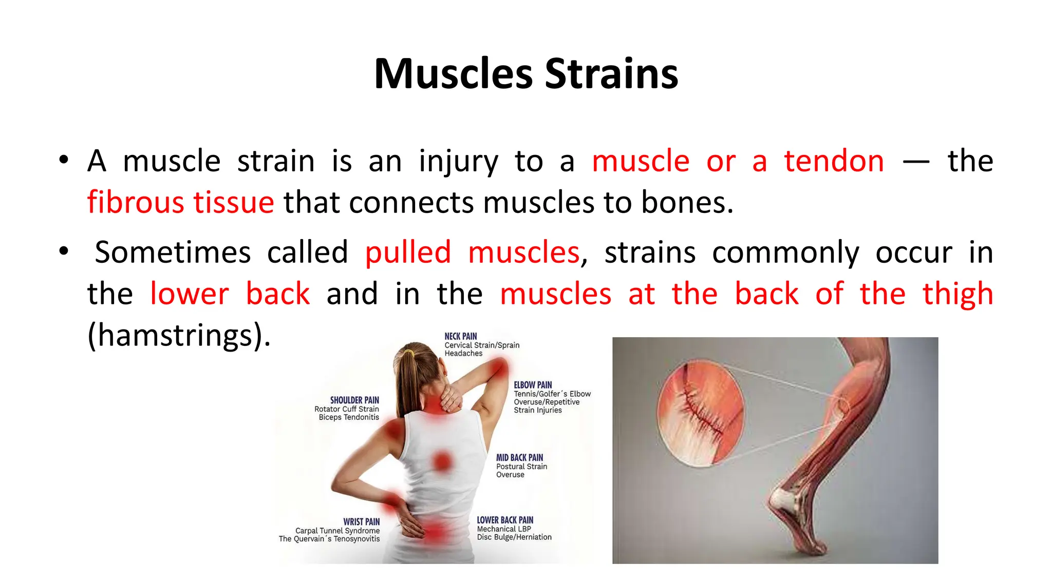 Bachelor in education notesCommon sports injuries.pptx