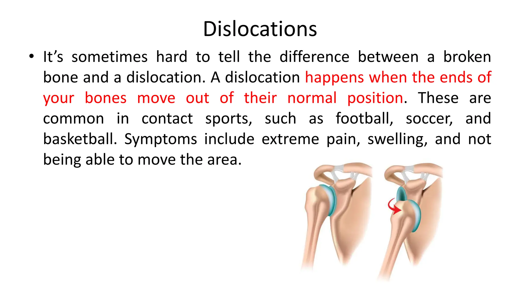 Bachelor in education notesCommon sports injuries.pptx