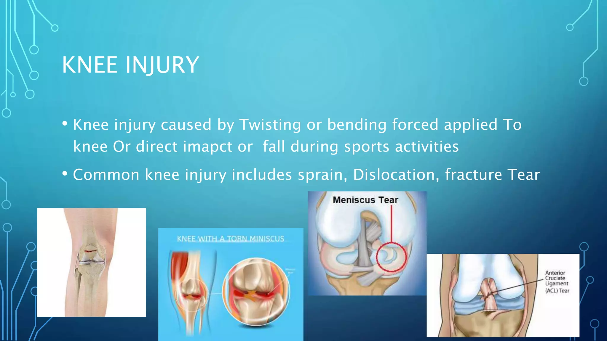 Common sports injuries and treatment | PPTX