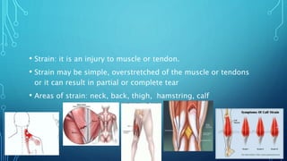Common sports injuries and treatment | PPTX