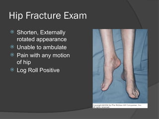 Common Sports Injuries of the Hip, Thigh and Groin.pptx