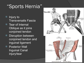 Common Sports Injuries of the Hip, Thigh and Groin.pptx