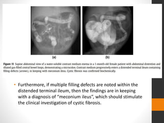 Common surgical abdomen scenarios and management dr.mounika | PPTX