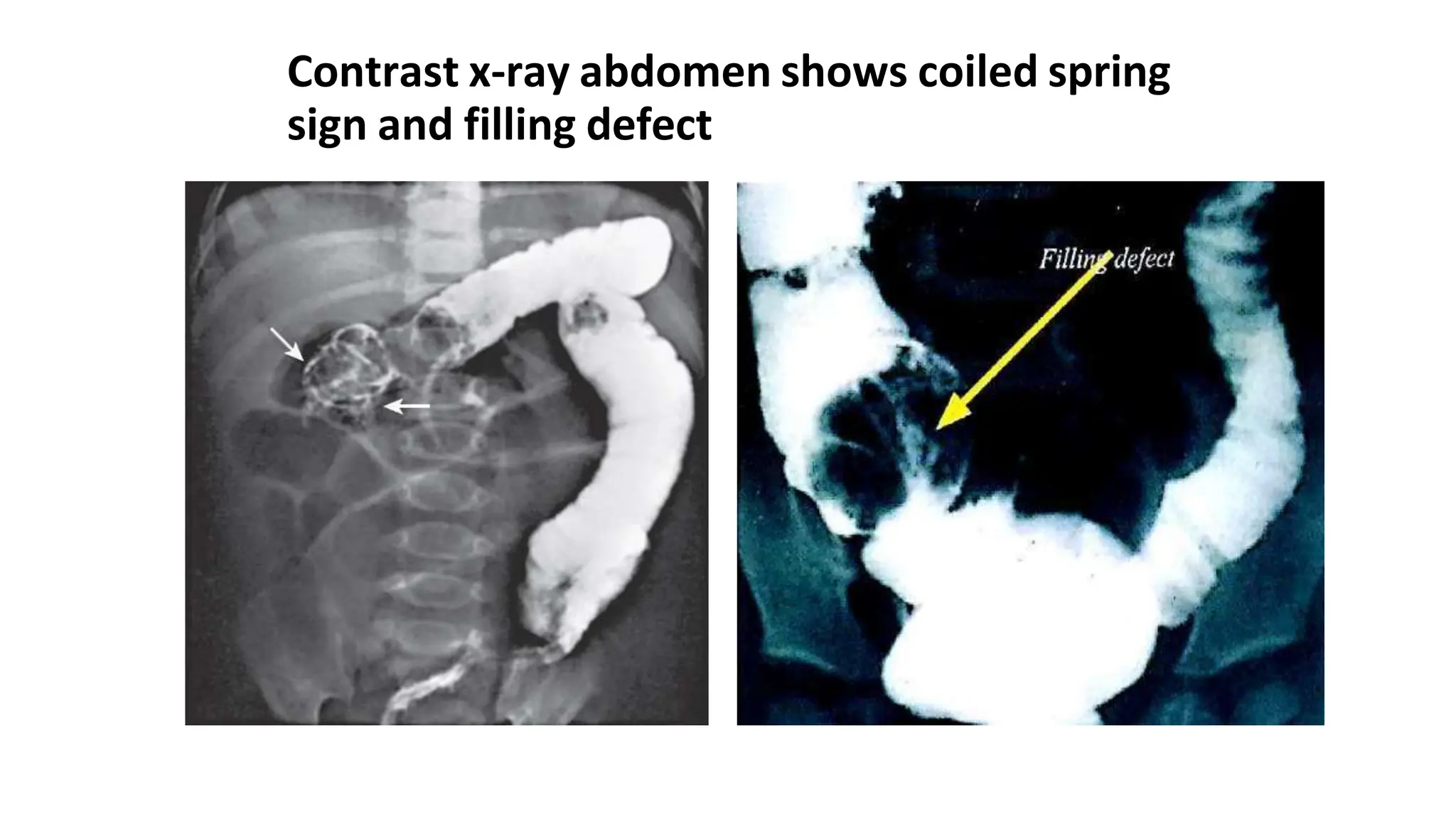 common surgical problem in pediatrics done.pptx