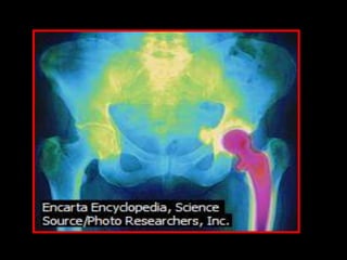Common Surgical Procedures | PPTX