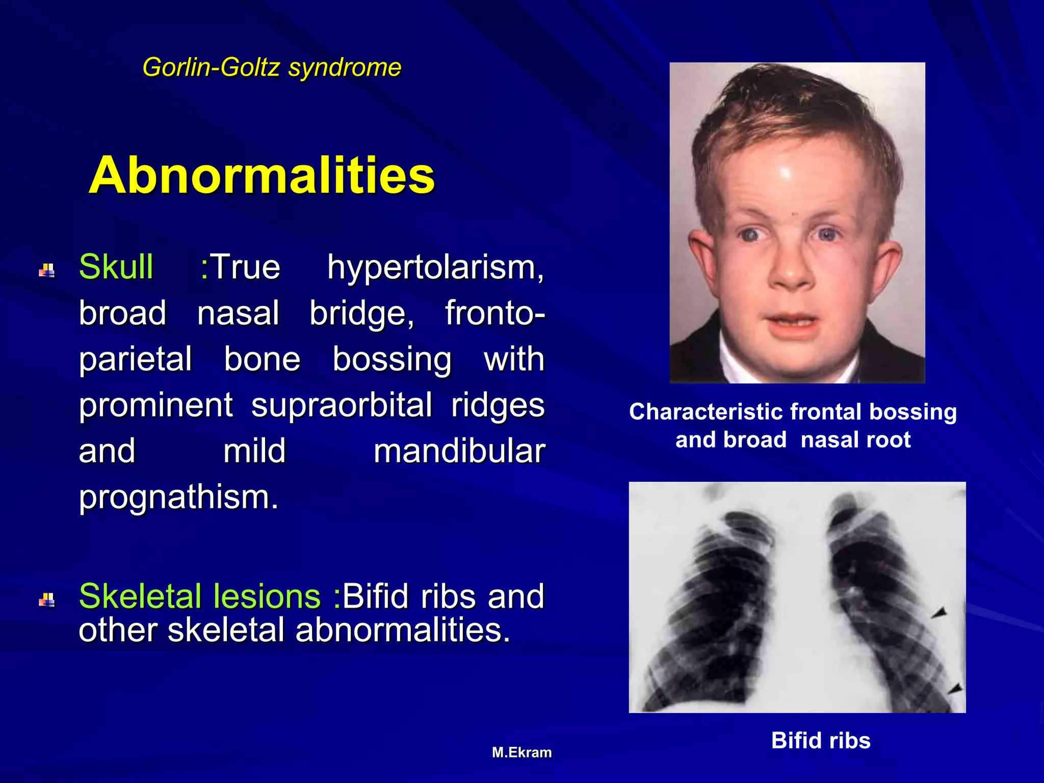 Common syndromes affecting the head & neck | PPT