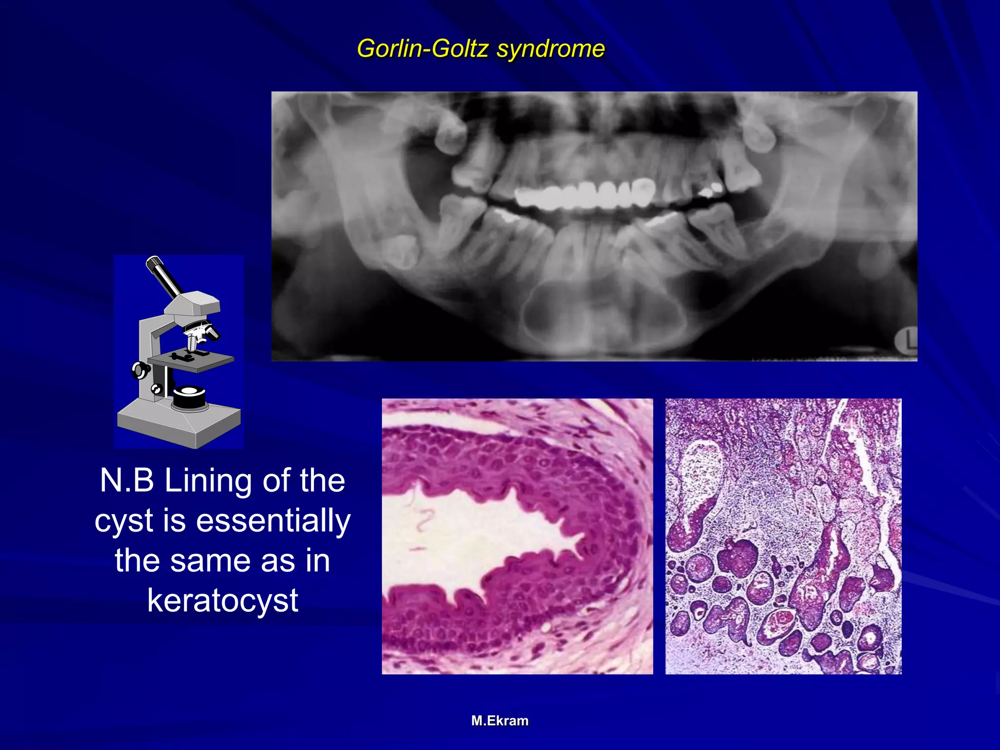 Common syndromes affecting the head & neck | PPT