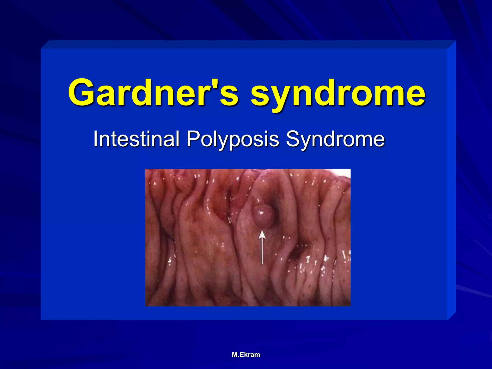 Common syndromes affecting the head & neck | PPT