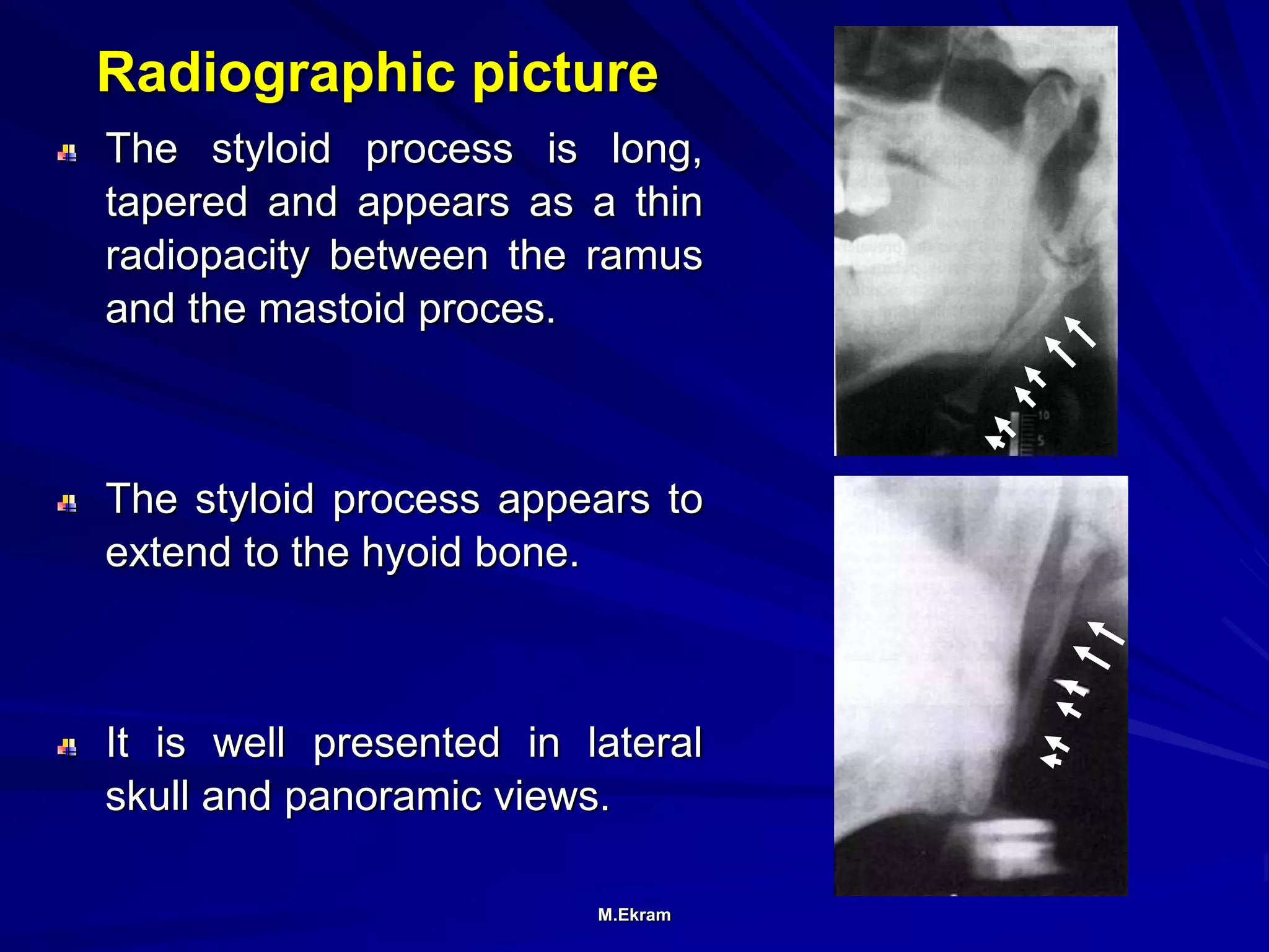 Common syndromes affecting the head & neck | PPT