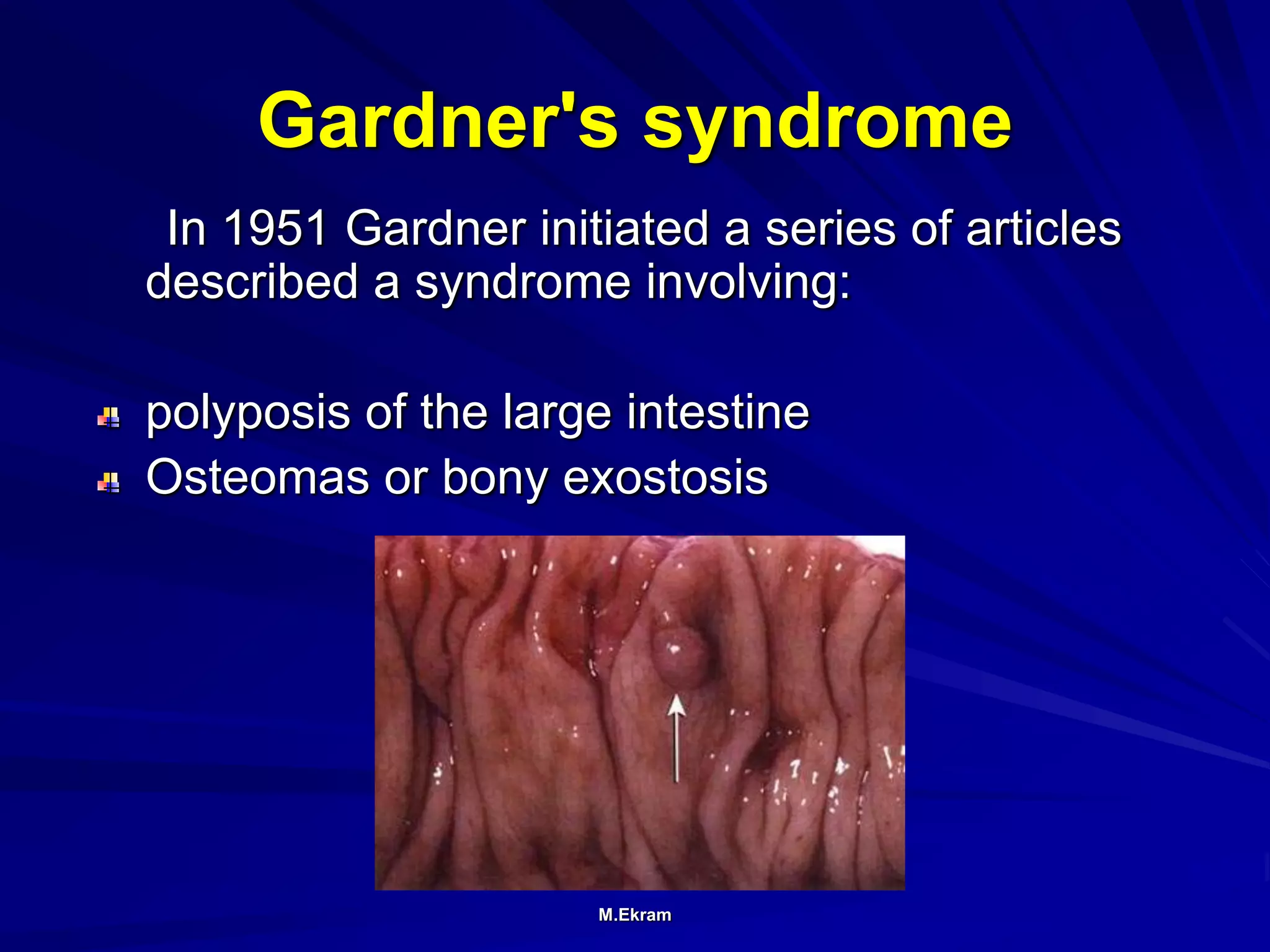 Common syndromes affecting the head & neck | PPT
