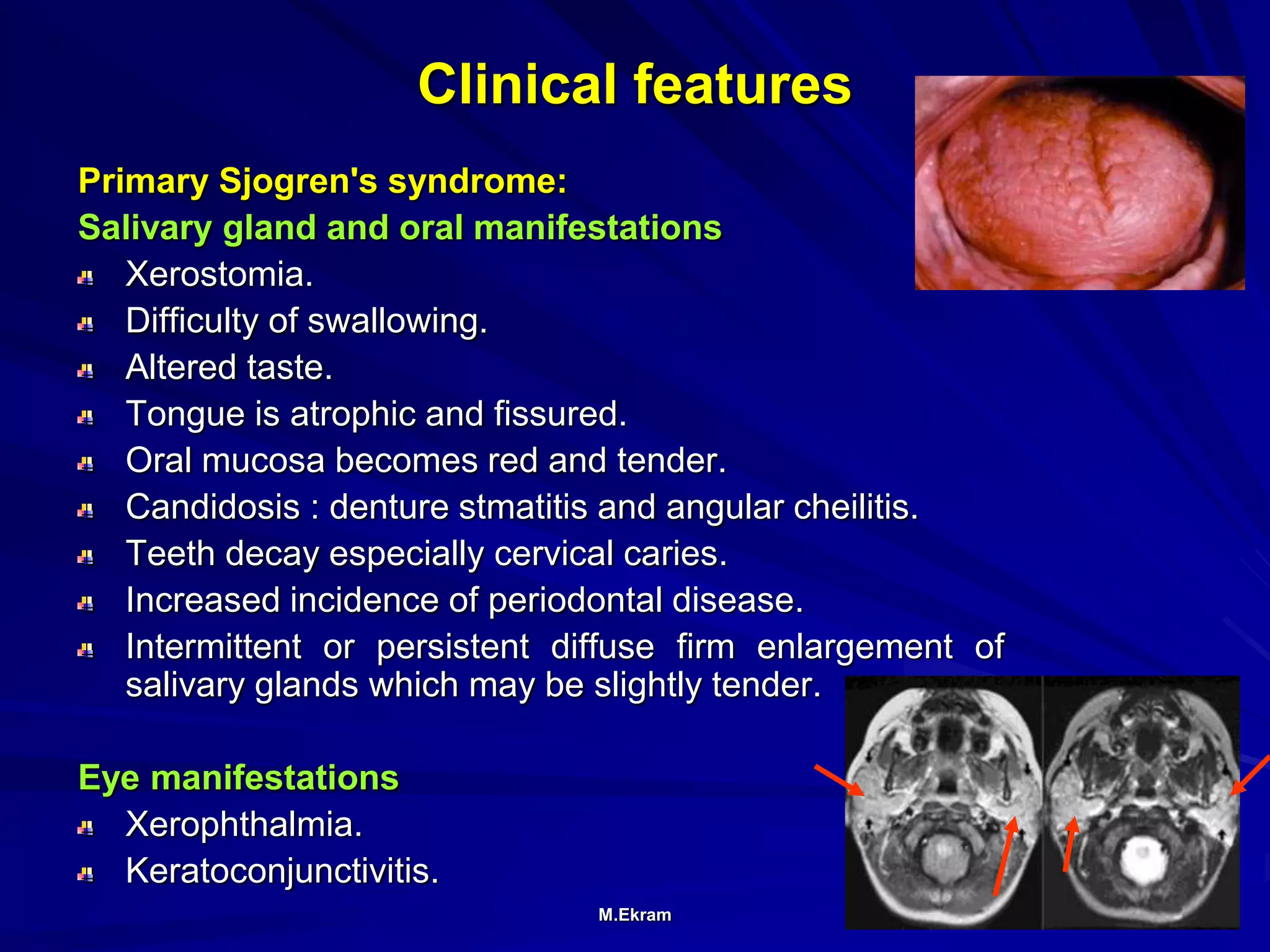 Common syndromes affecting the head & neck | PPT
