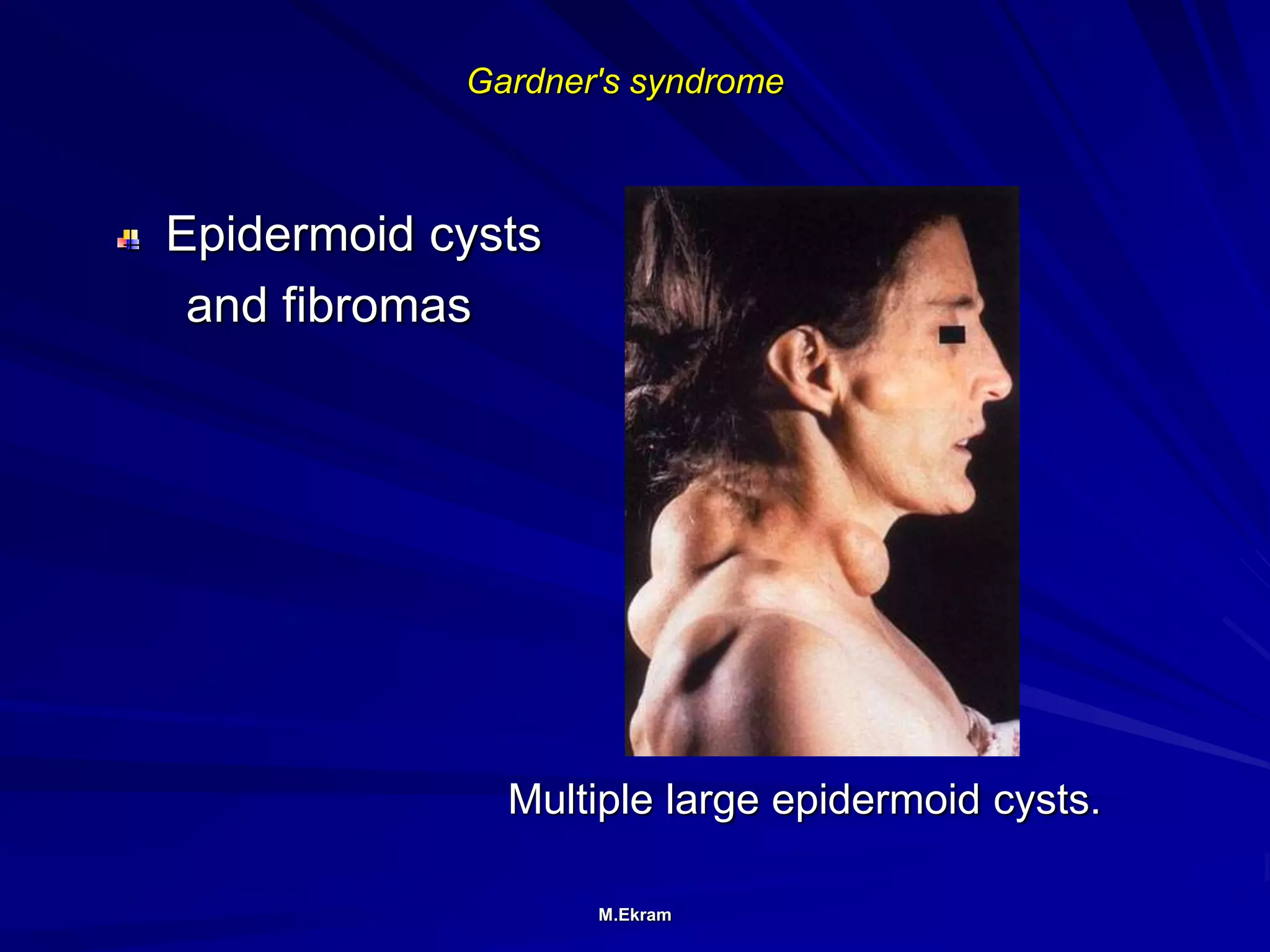 Common syndromes affecting the head & neck | PPT