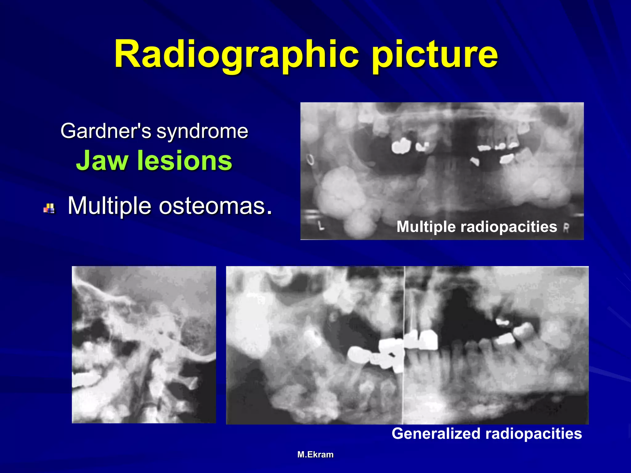 Common syndromes affecting the head & neck | PPT