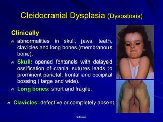 Common syndromes affecting the head & neck | PPT