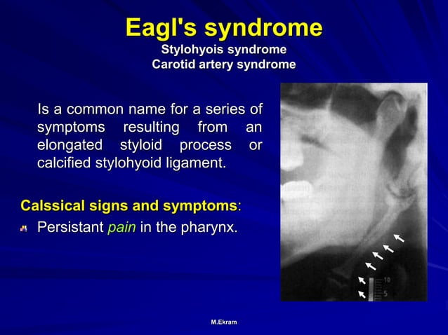 Common syndromes affecting the head & neck | PPT