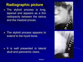 Common syndromes affecting the head & neck | PPT