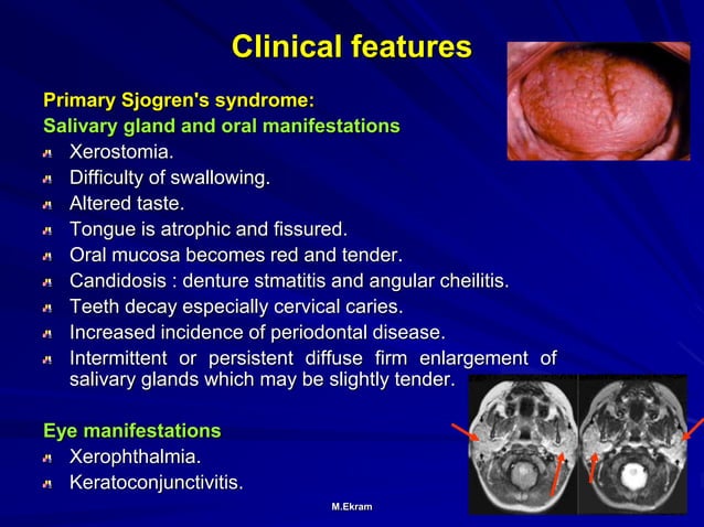 Common syndromes affecting the head & neck | PPT