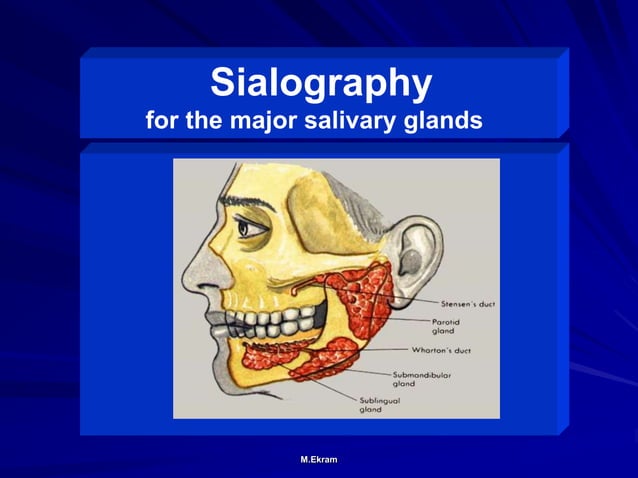 Common syndromes affecting the head & neck | PPT