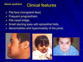 Common syndromes affecting the head & neck | PPT