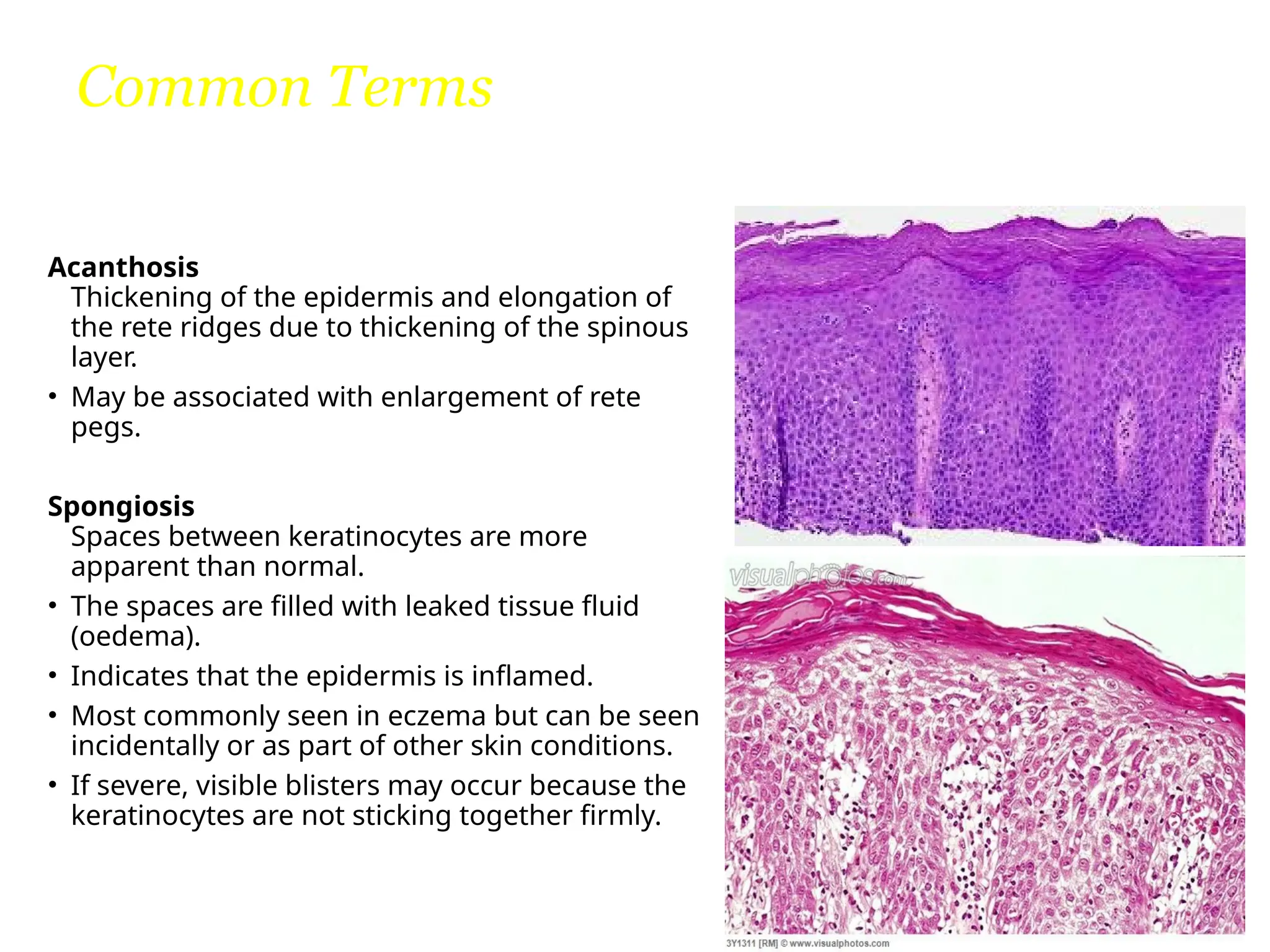 Common terms in skin diseases in human.pptx