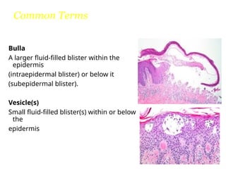 Common terms in skin diseases in human.pptx