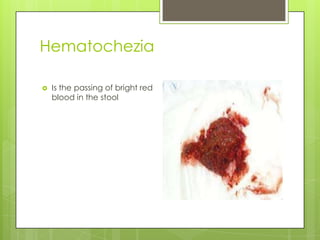 Common terms of the digestive system chapter8 | PPTX | Digestive ...