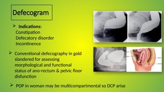 common investigations for pelvic floor.pptx