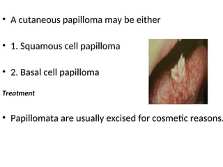 COMMON TUMORS - GENERAL DESCRIPTION PART I | PPT