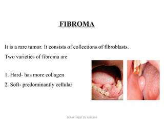 COMMON TUMORS - GENERAL DESCRIPTION PART I | PPT
