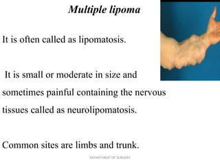 COMMON TUMORS - GENERAL DESCRIPTION PART I | PPT