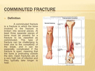 Common Types Of Fracture | PPTX
