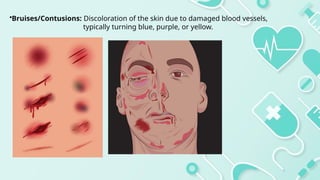 Common Types of Injuries and their visual indicators | PPTX
