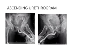 COMMON URINARY TRACT CONDITIONS-somed.pptx