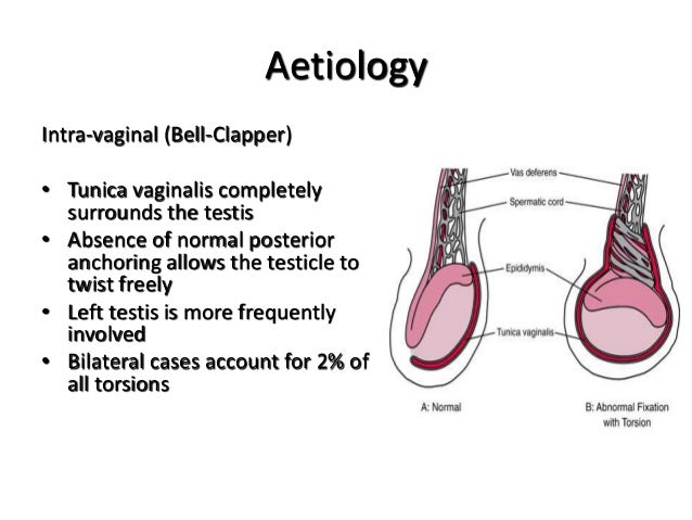 Common Urological Emergencies