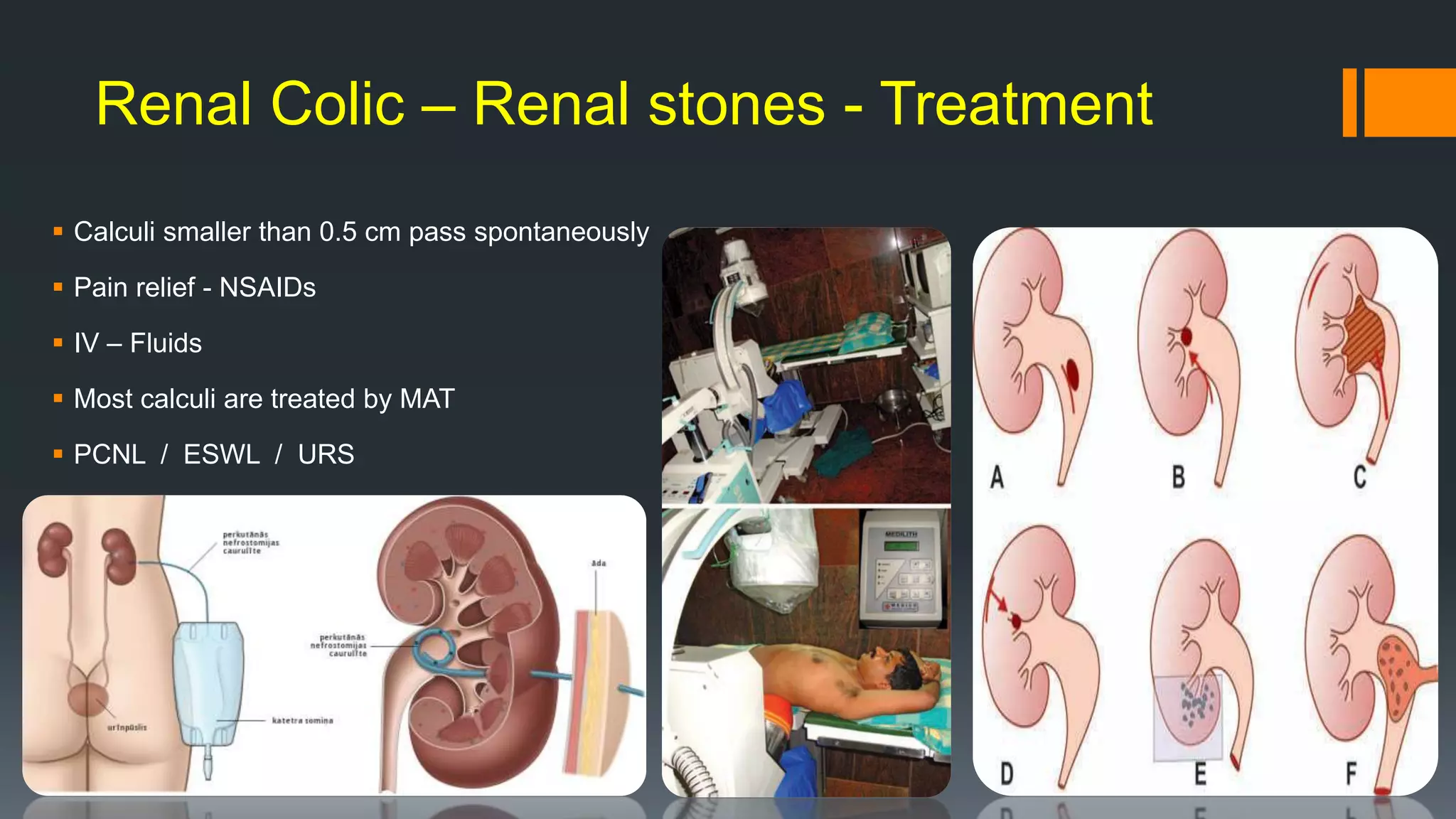 Common urological emergencies | PPTX
