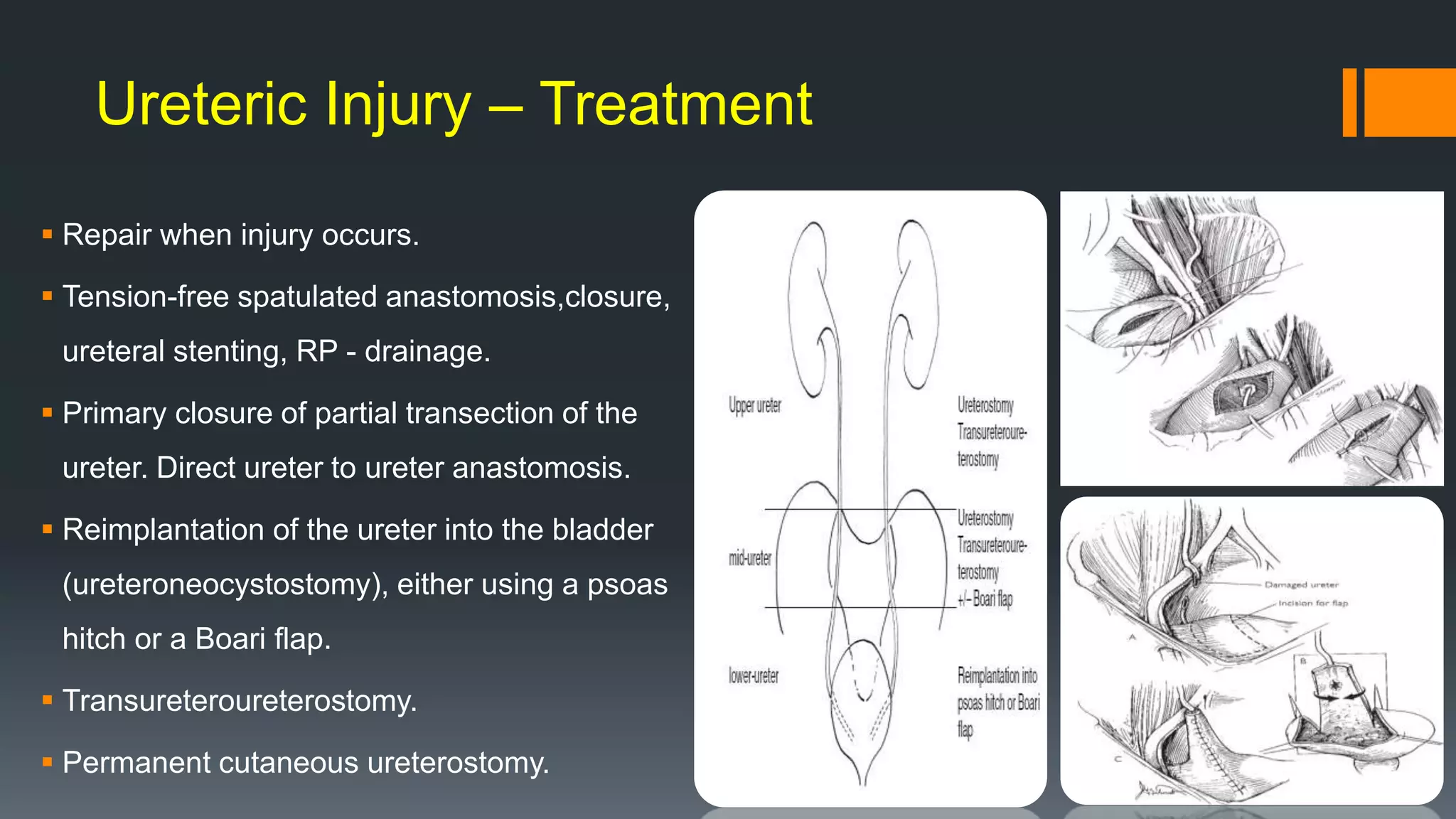 Common urological emergencies | PPTX