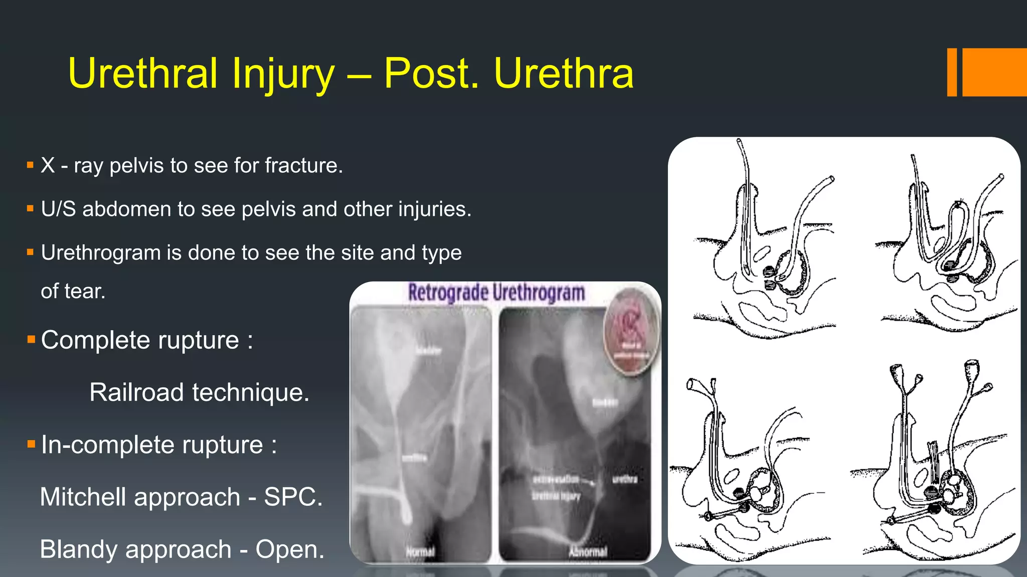 Common urological emergencies | PPTX