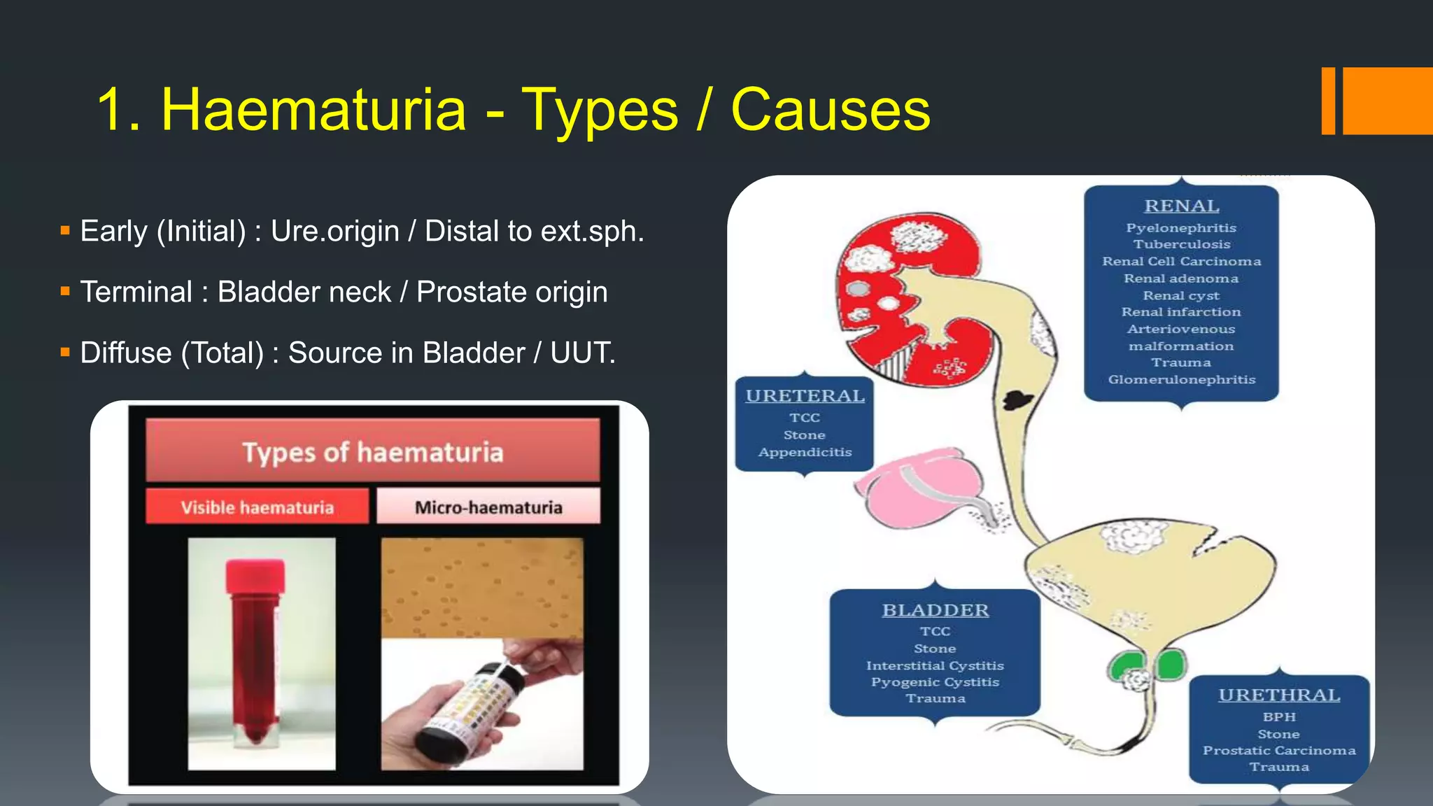 Common urological emergencies | PPTX