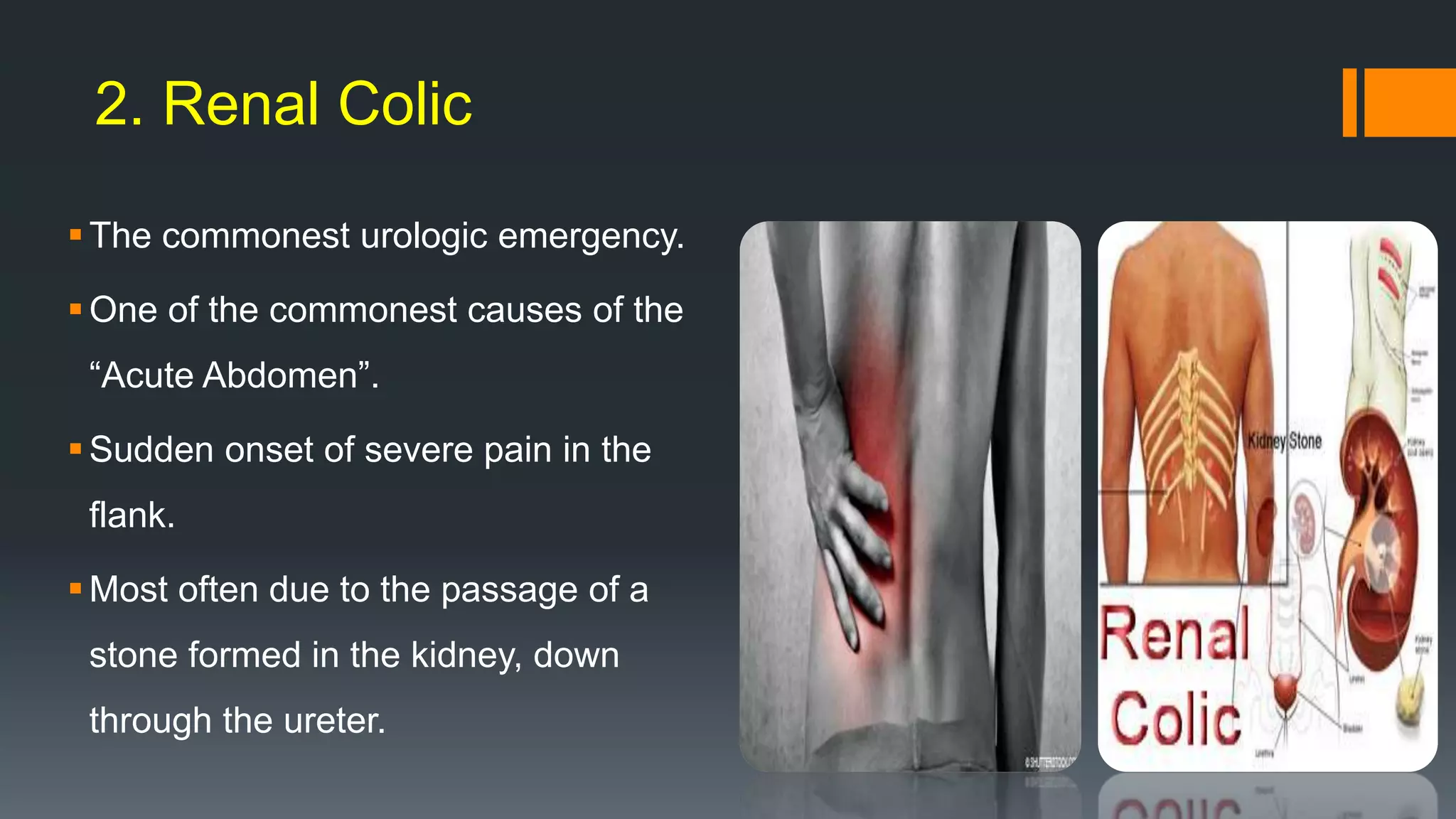 Common urological emergencies | PPTX