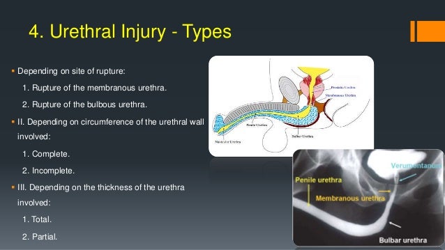 Common urological emergencies