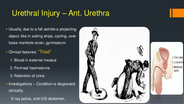 Common urological emergencies