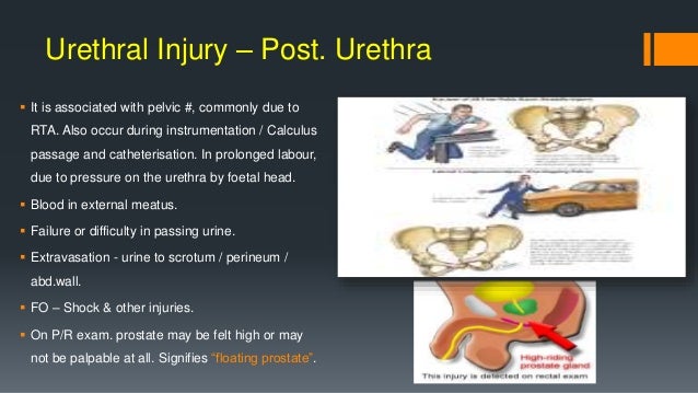 Common urological emergencies