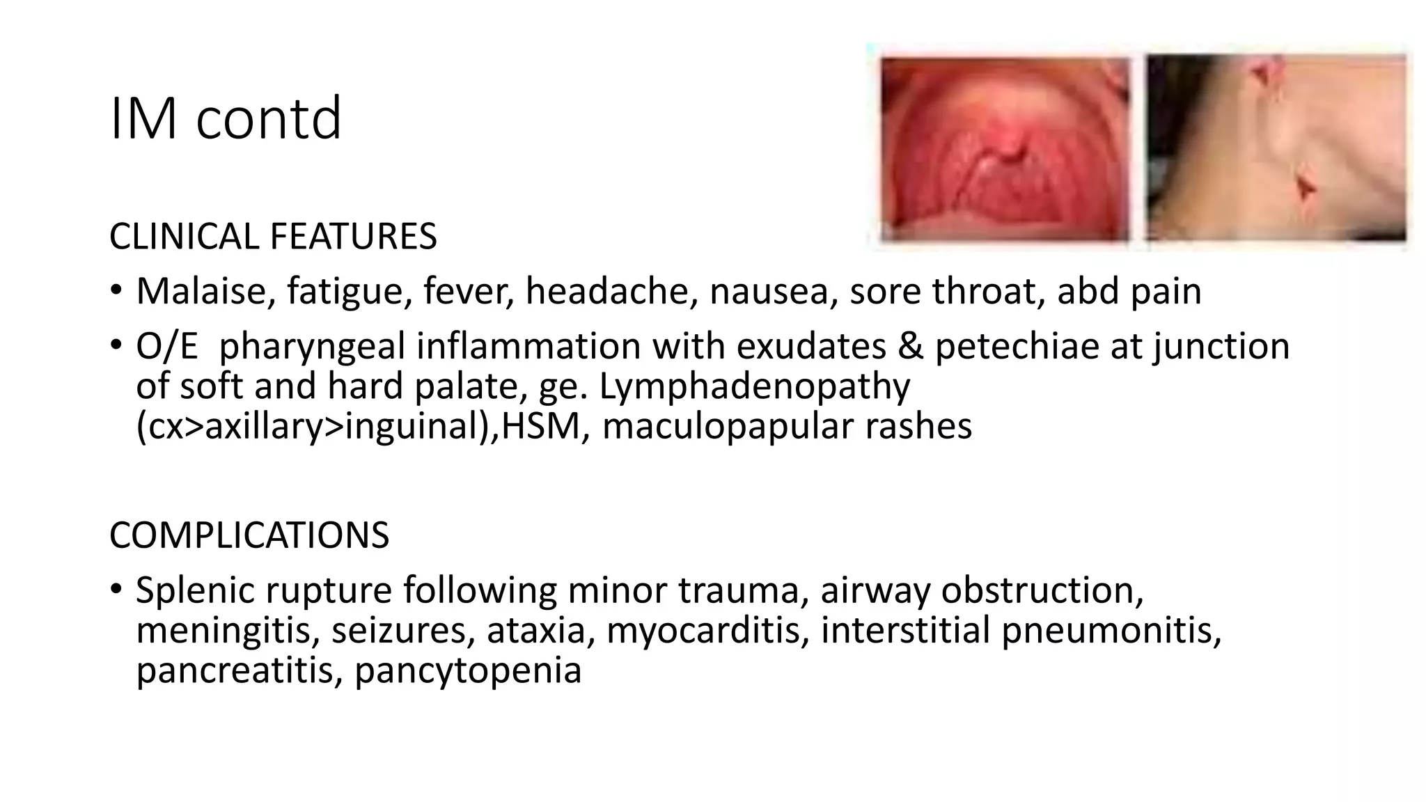 Common Viral Infections in children.pptx